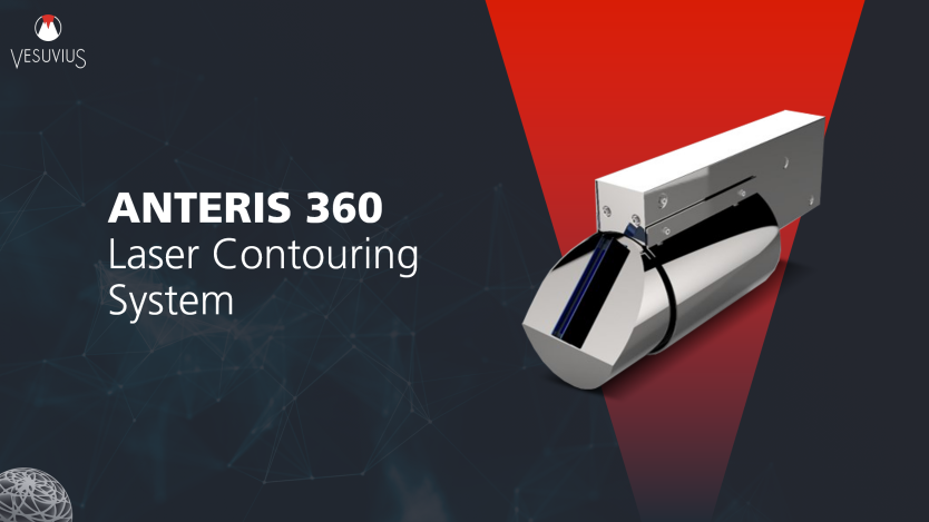 Anteris 360 - Vesuvius